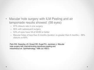ILM Friend or Foe | PPTX | Eye and Vision Conditions | Diseases and ...