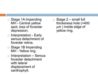 MACULAR HOLE.pptx
