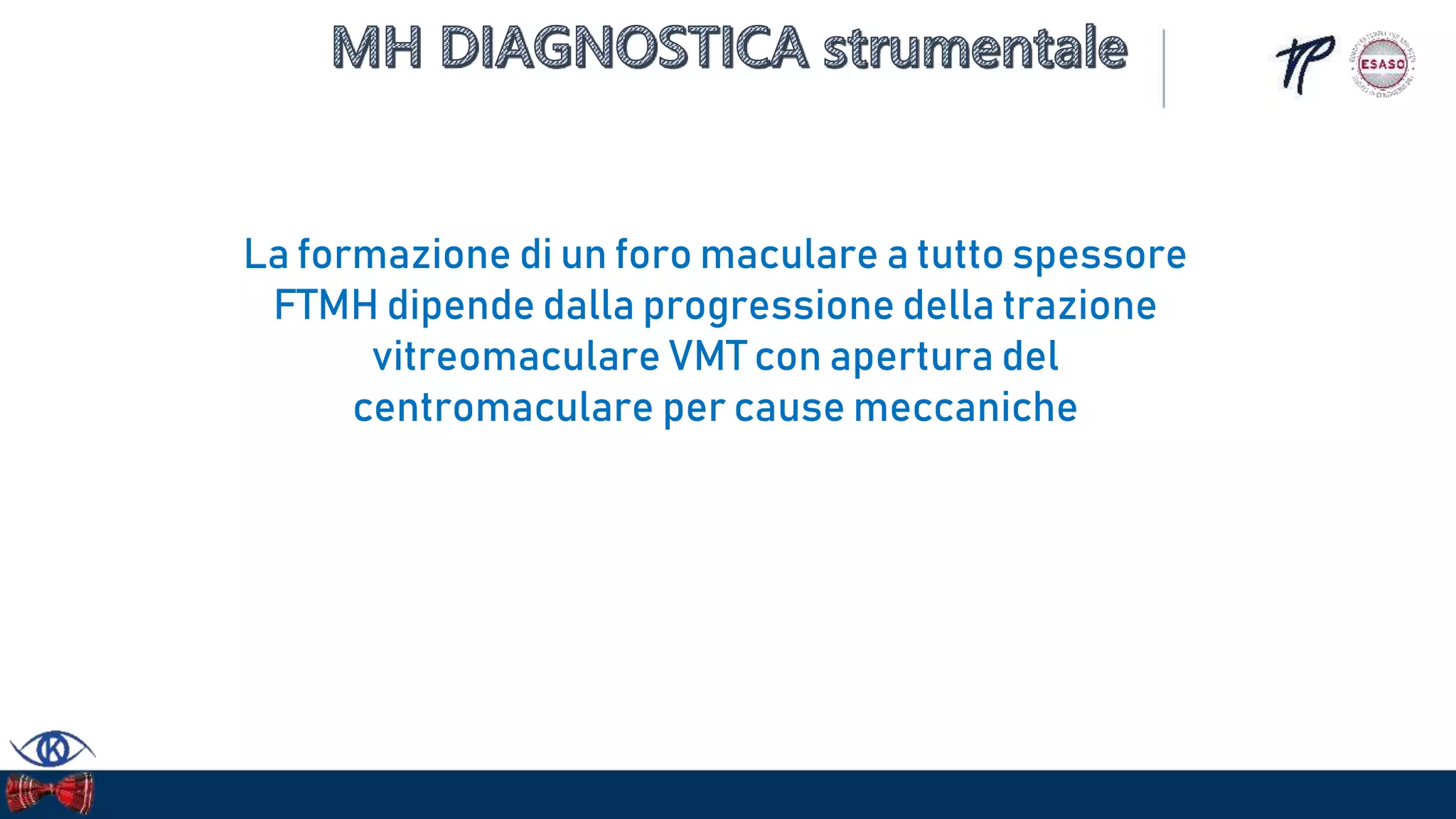MACULAR HOLE in MYOPIC EYES DrCanali 20 Aprile23 Lugano.pptx