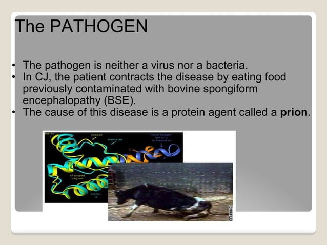 Creutzfeldt-Jacob Disease | PPT | Infectious Diseases | Diseases and ...