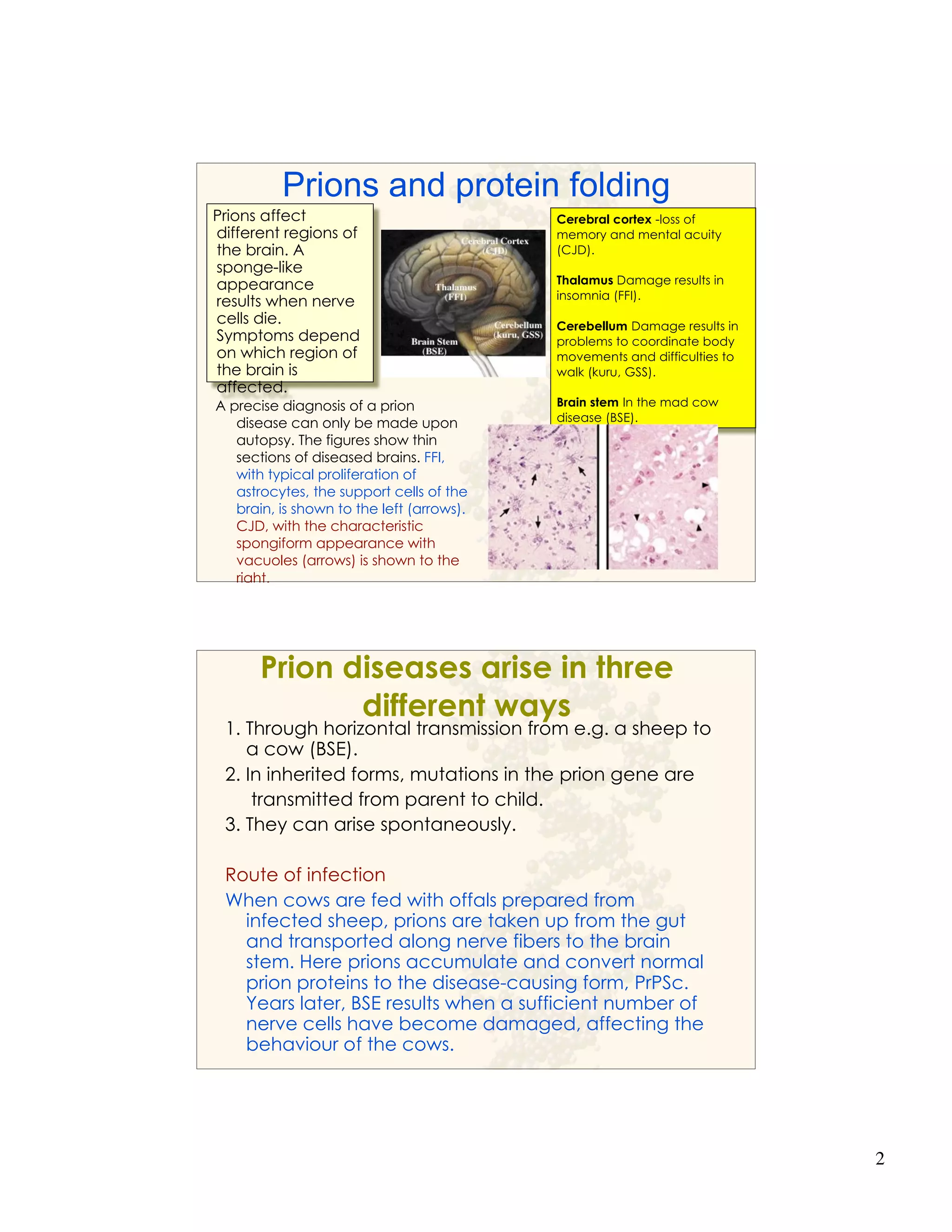 Mad Cow Disease and Variant Creutzfeldt-Jakob Disease | PDF
