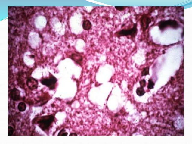 BOVINE SPONGIFORM ENCEPHALOPHATHY (BSE), MAD COW | PPTX | Brain and ...
