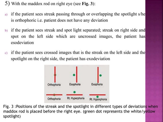Maddox rod and double maddox rod | PPTX | Eye and Vision Conditions ...