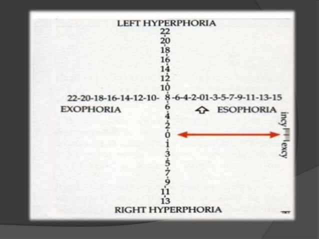Maddox rod n wing | PPTX
