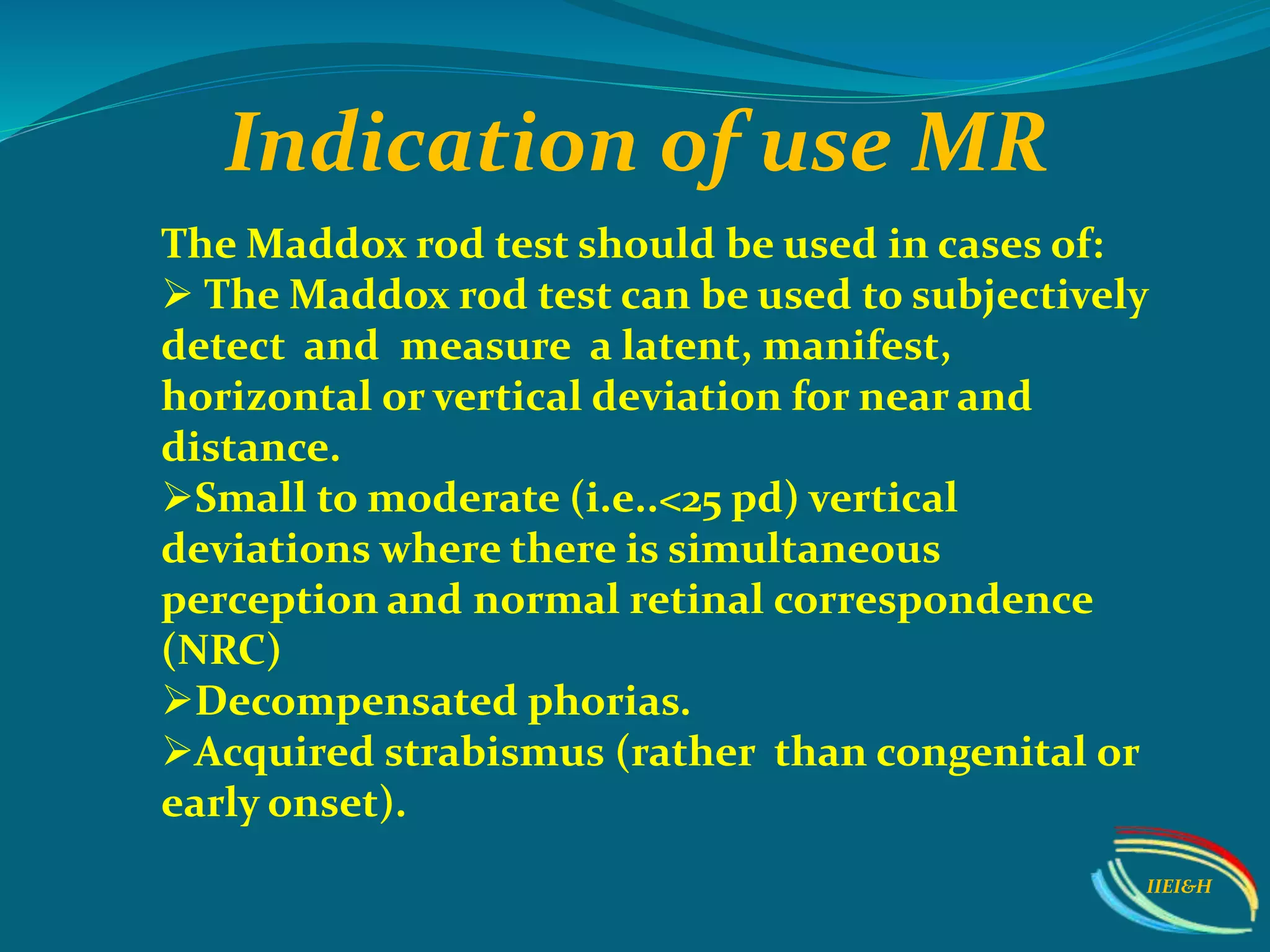 Maddox Rod test | PPTX
