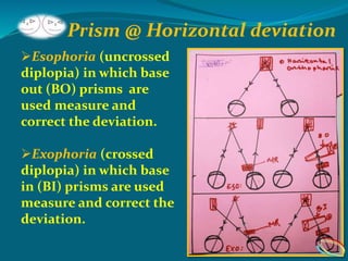 Maddox Rod test | PPTX