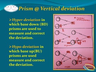 Maddox Rod test | PPTX