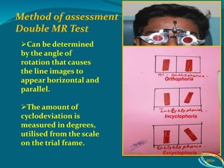 Maddox Rod test | PPTX