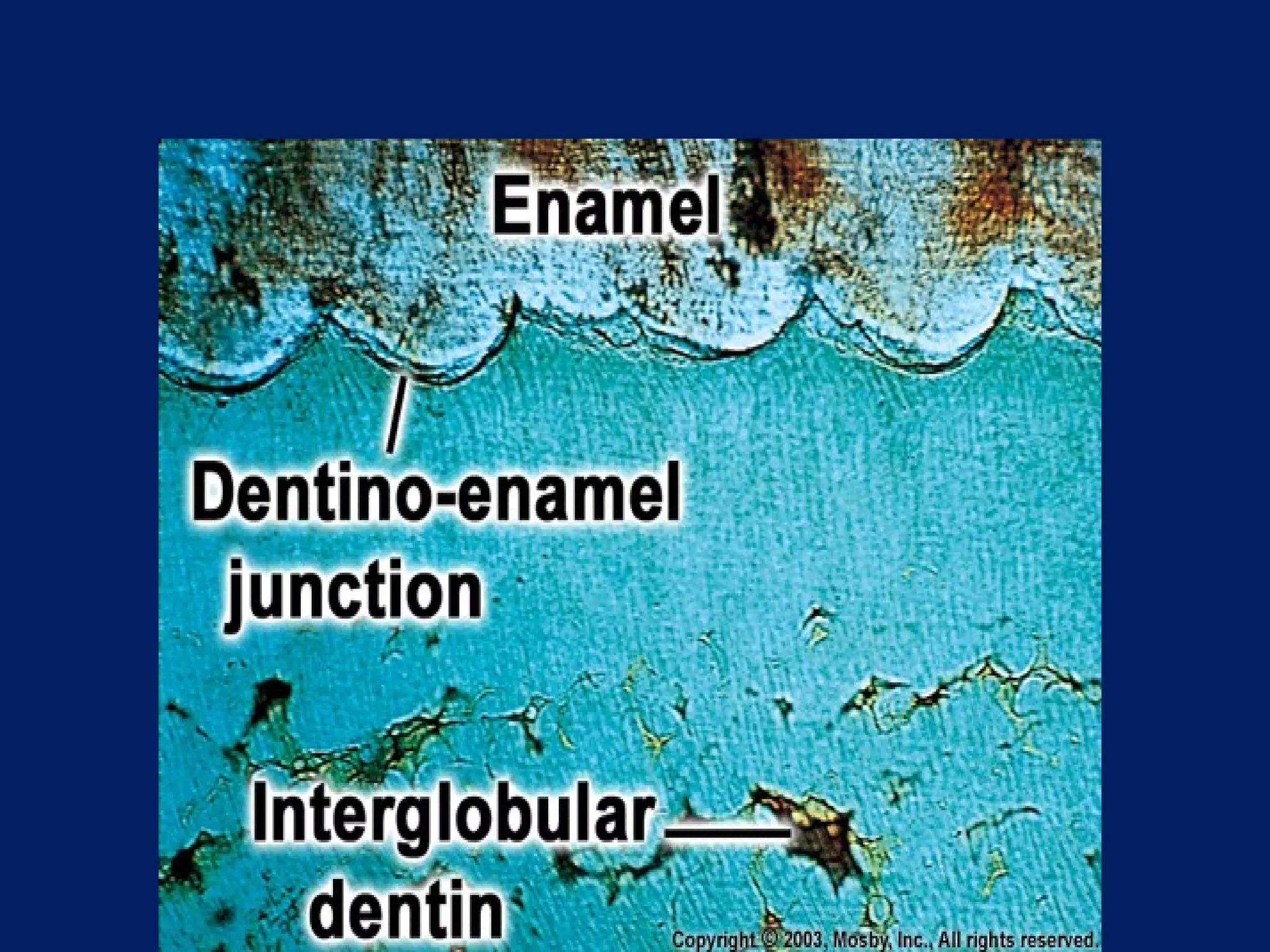 Tooth Dentin and dentinogenesis ppt | PPT