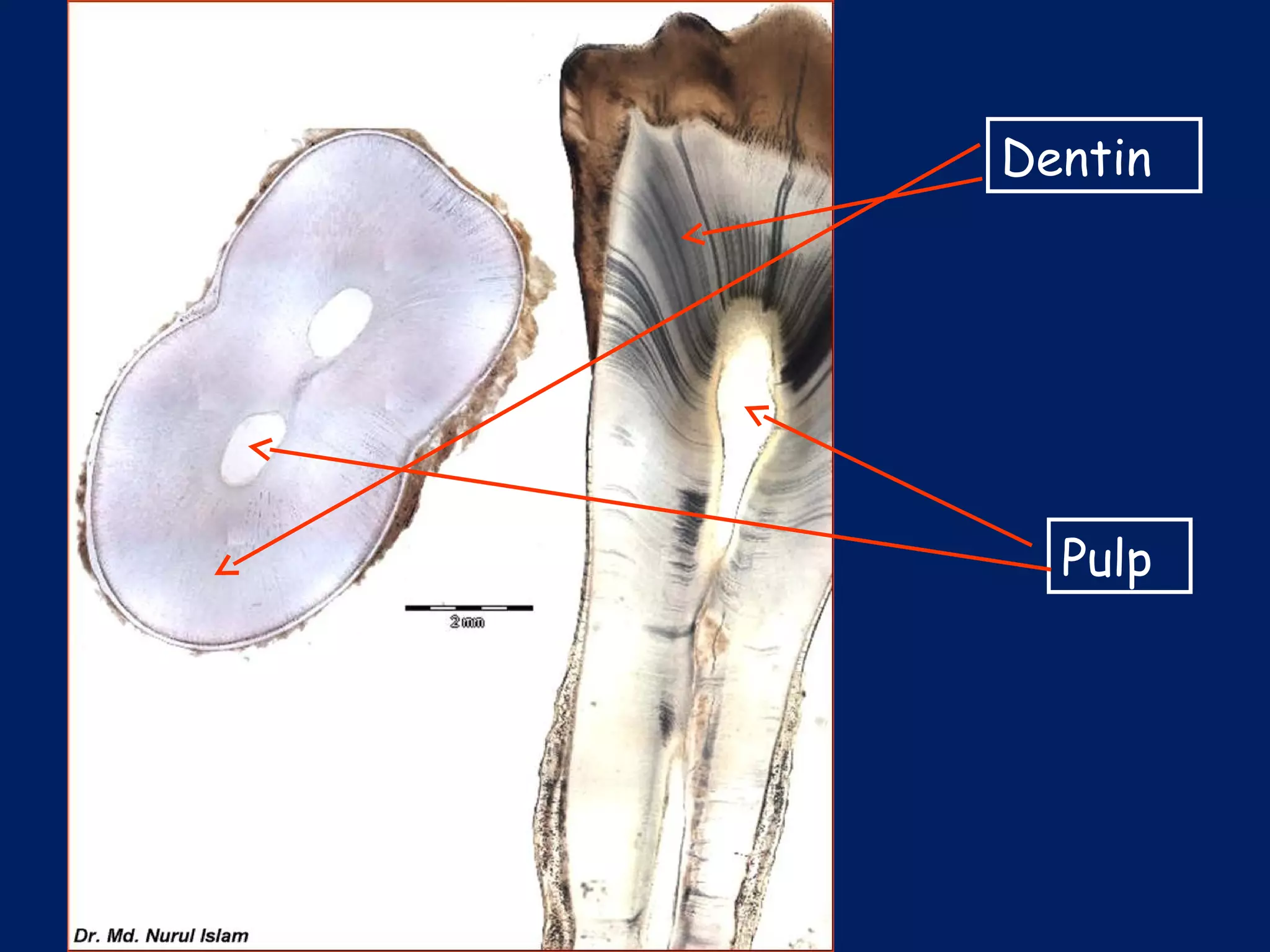 Tooth Dentin and dentinogenesis ppt | PPT