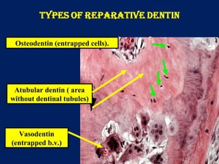 Tooth Dentin and dentinogenesis ppt | PPT
