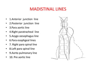 Madiastinal lines | PPT