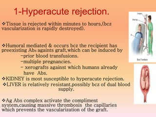 TRANSPLATATION REJECTION STAGES. | PPT
