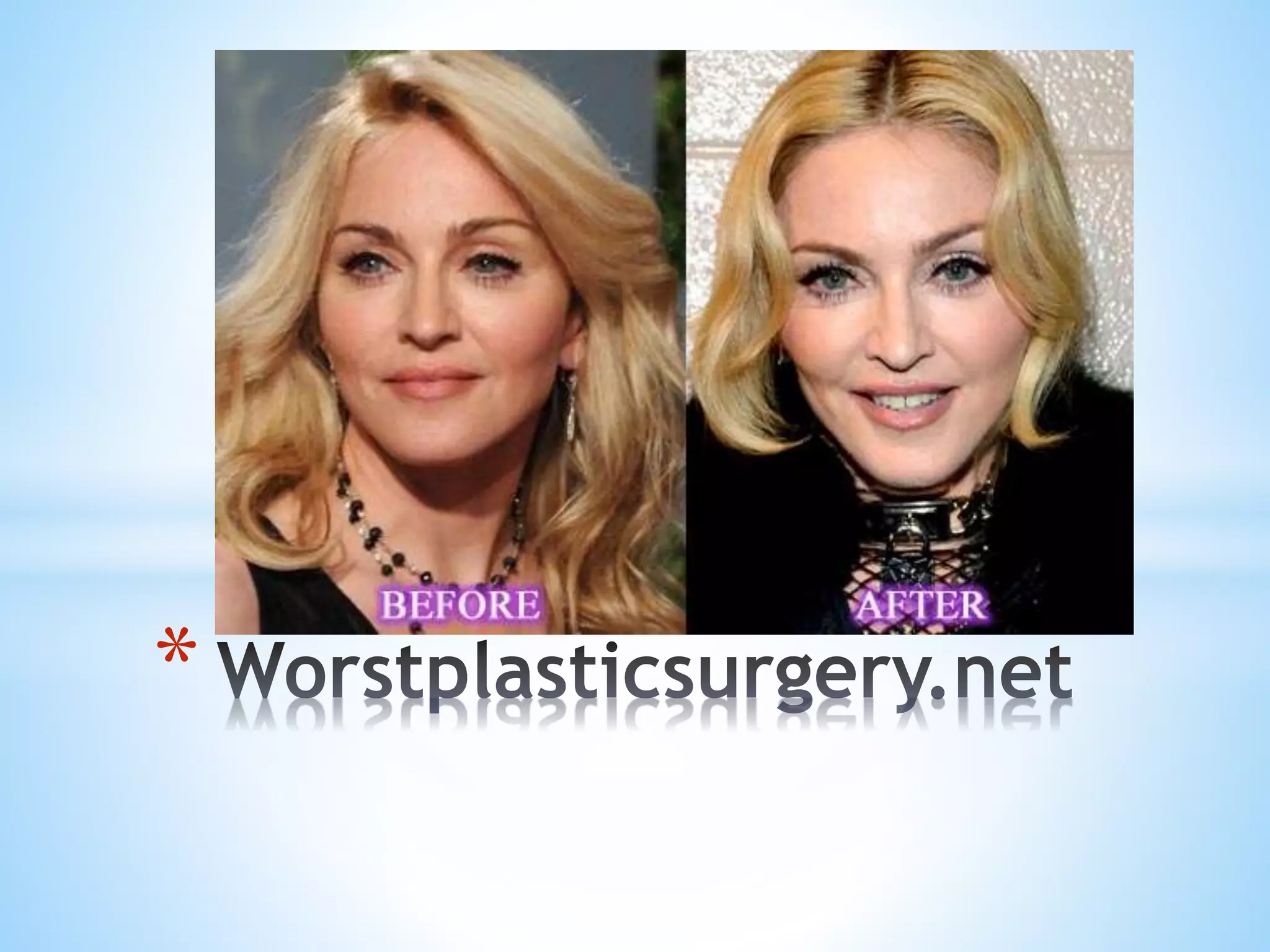 Madonna Plastic Surgery Gallery | PPTX
