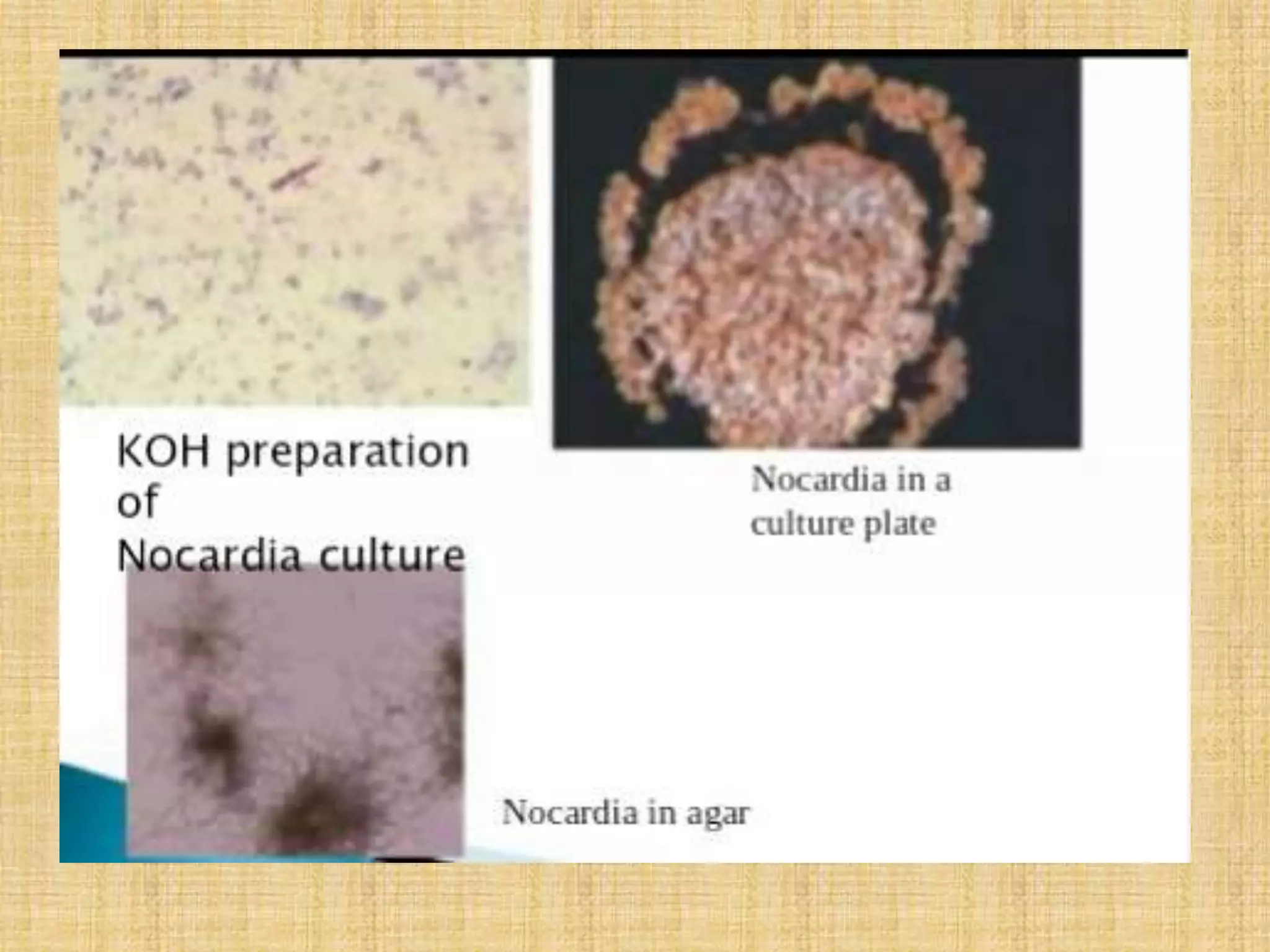 Madura foot ppt | PPTX
