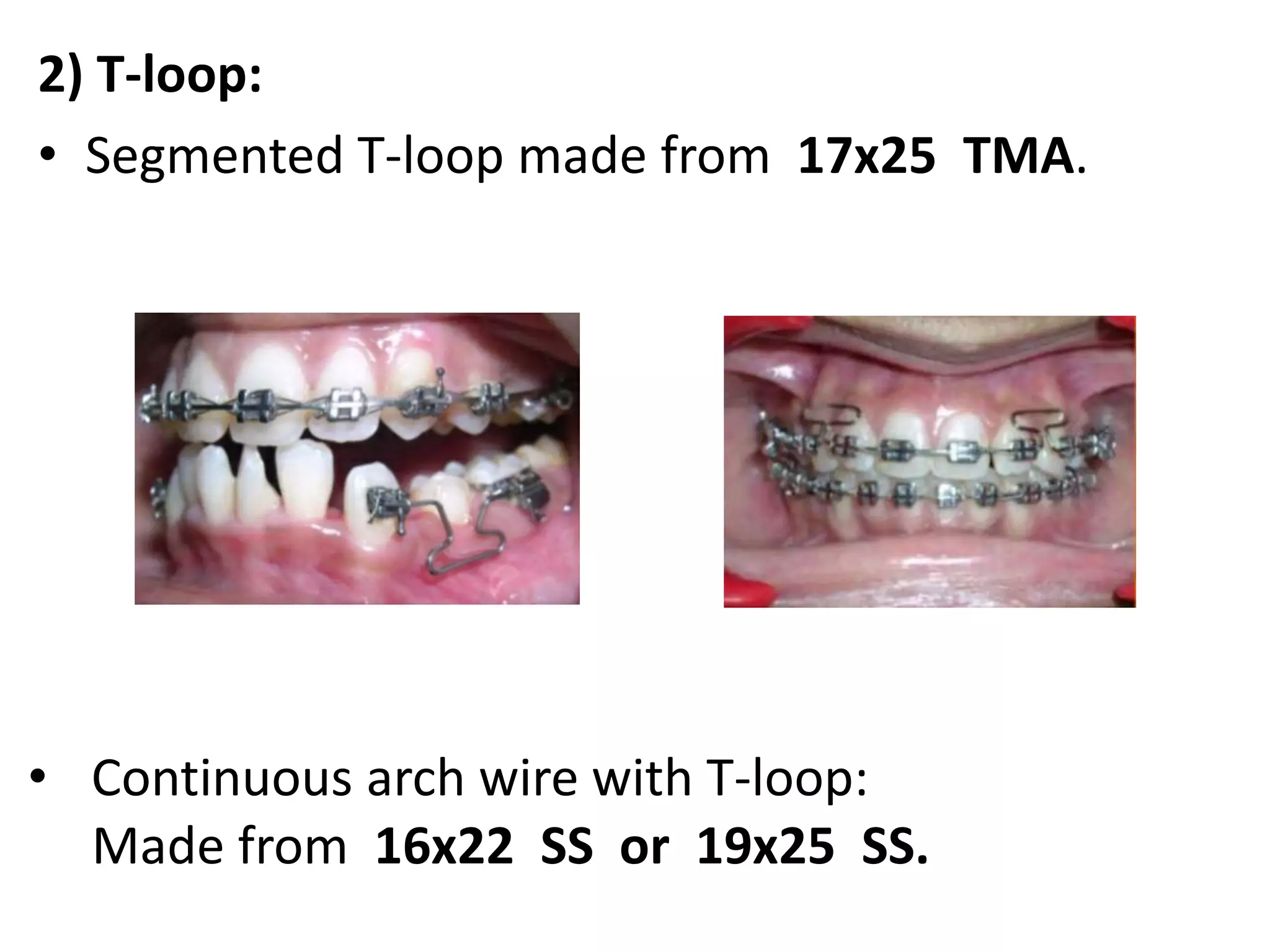 Maeen lecture corrected | PPTX