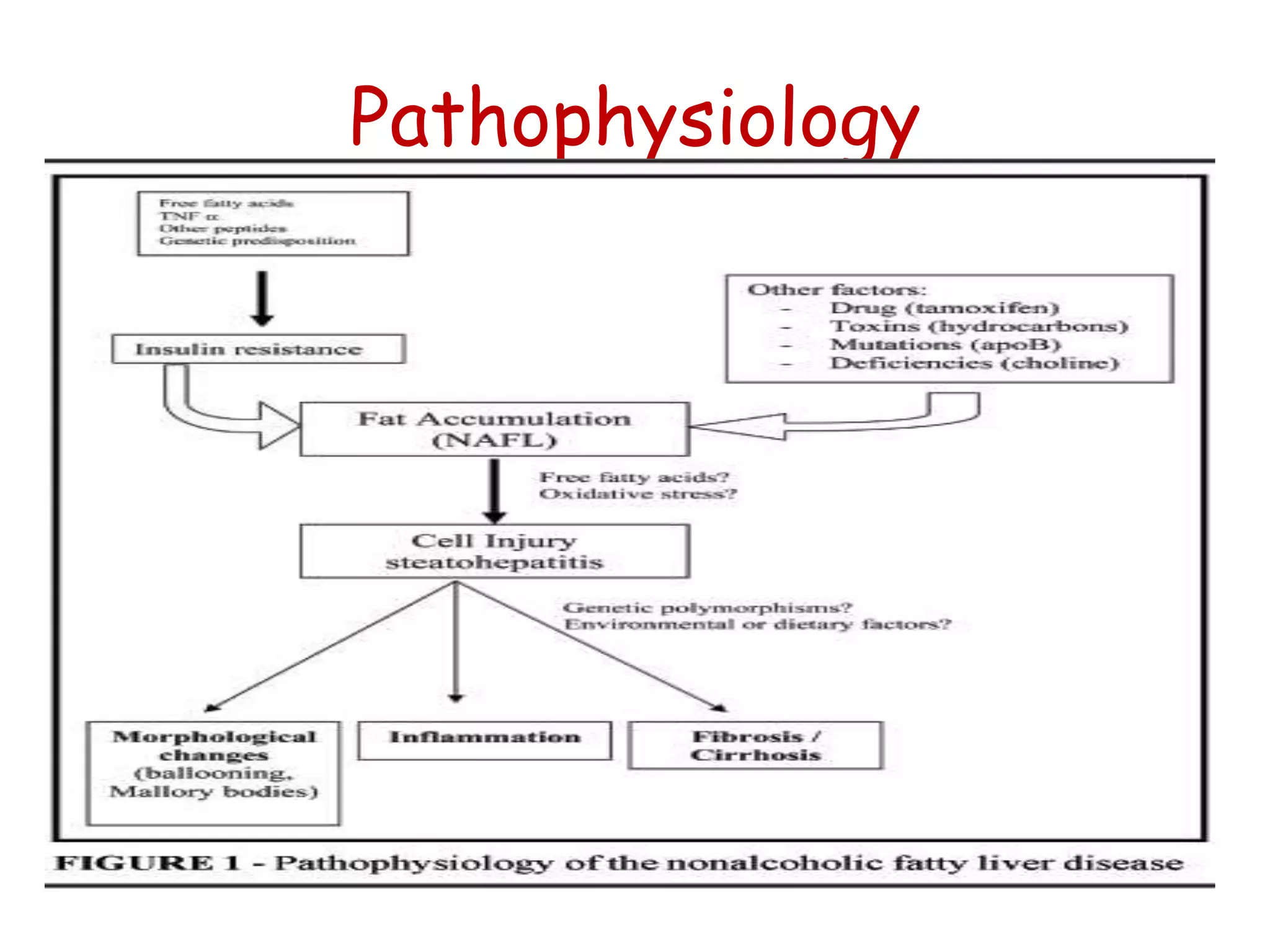 MAFLD, a new name of an old disease | PDF