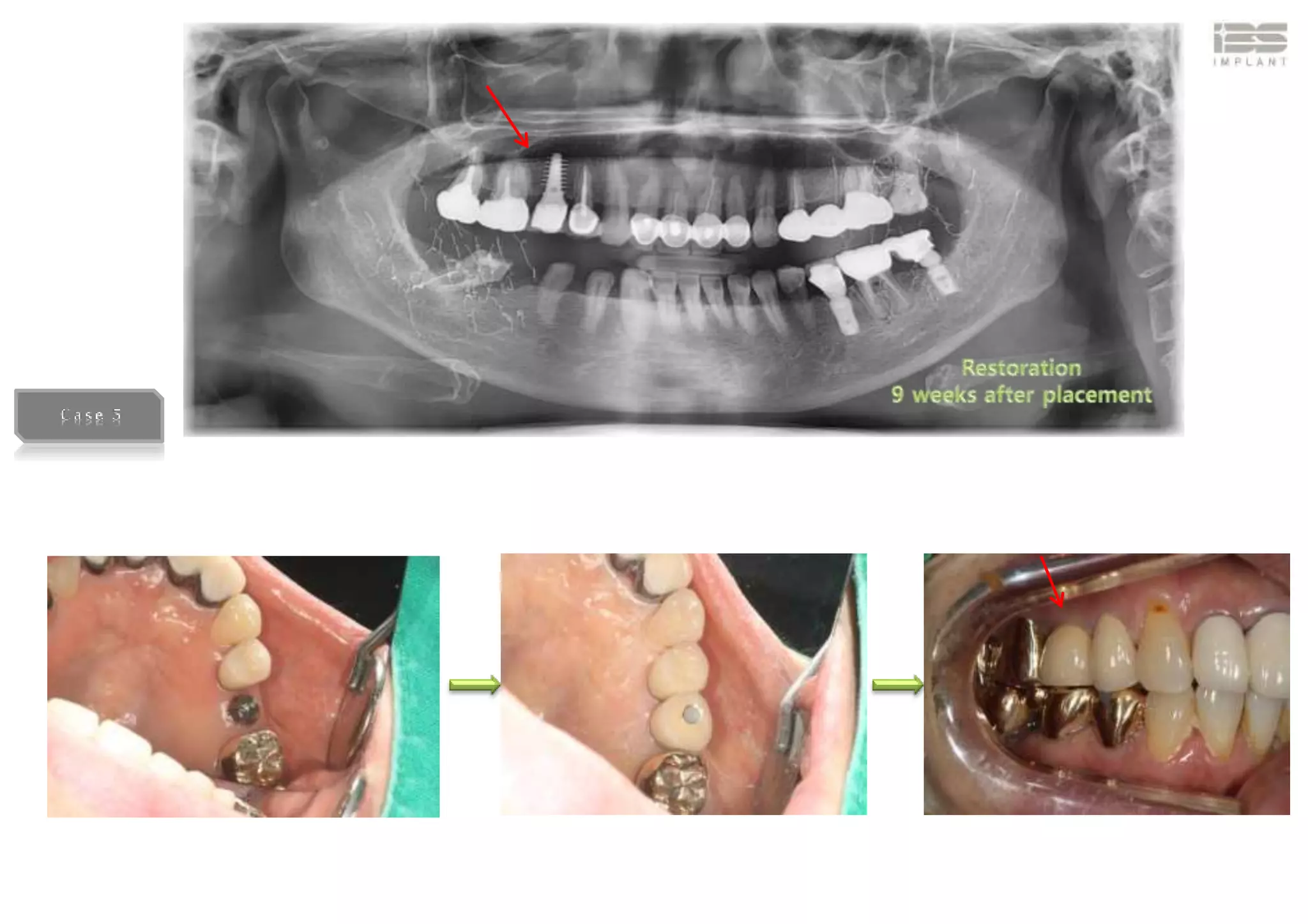Magicore Clinical Cases. | PPTX