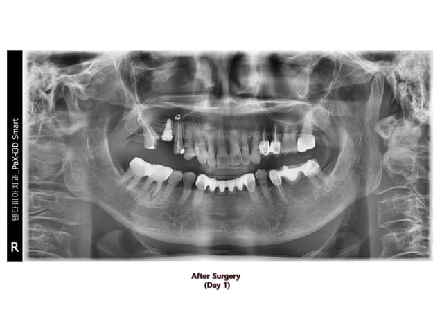 Magicore Clinical Cases. | PPTX | Dental Health | Diseases and Conditions