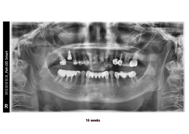 Magicore Clinical Cases. | PPTX | Dental Health | Diseases and Conditions