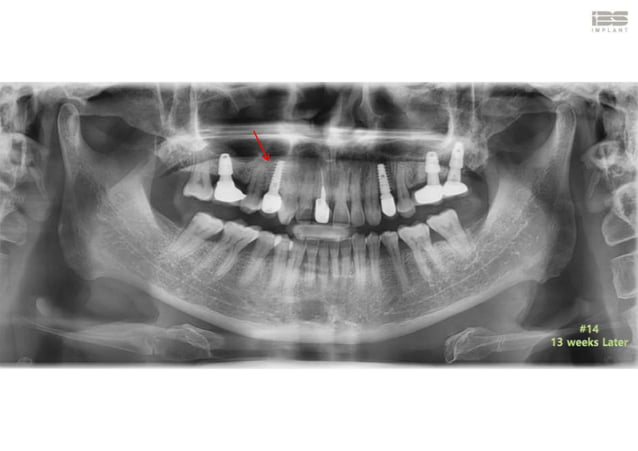 Magicore Clinical Cases. | PPTX | Dental Health | Diseases and Conditions
