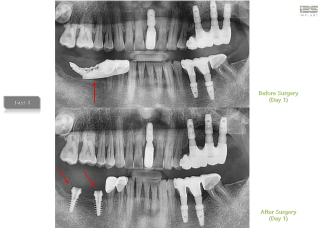 Magicore Clinical Cases. | PPTX | Dental Health | Diseases and Conditions