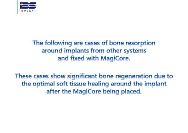 Replacement with Magicore due to severe resorption with other system | PPTX