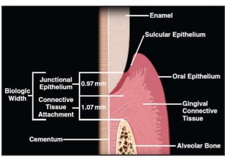 Replacement with Magicore due to severe resorption with other system | PPTX