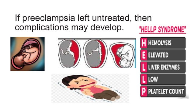 PIH | Pregnancy induced hypertension | eclampsia and pre eclampsia ...