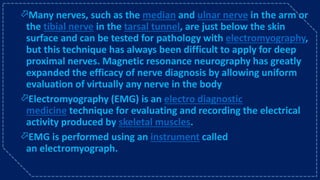 MR Neurography | PPTX