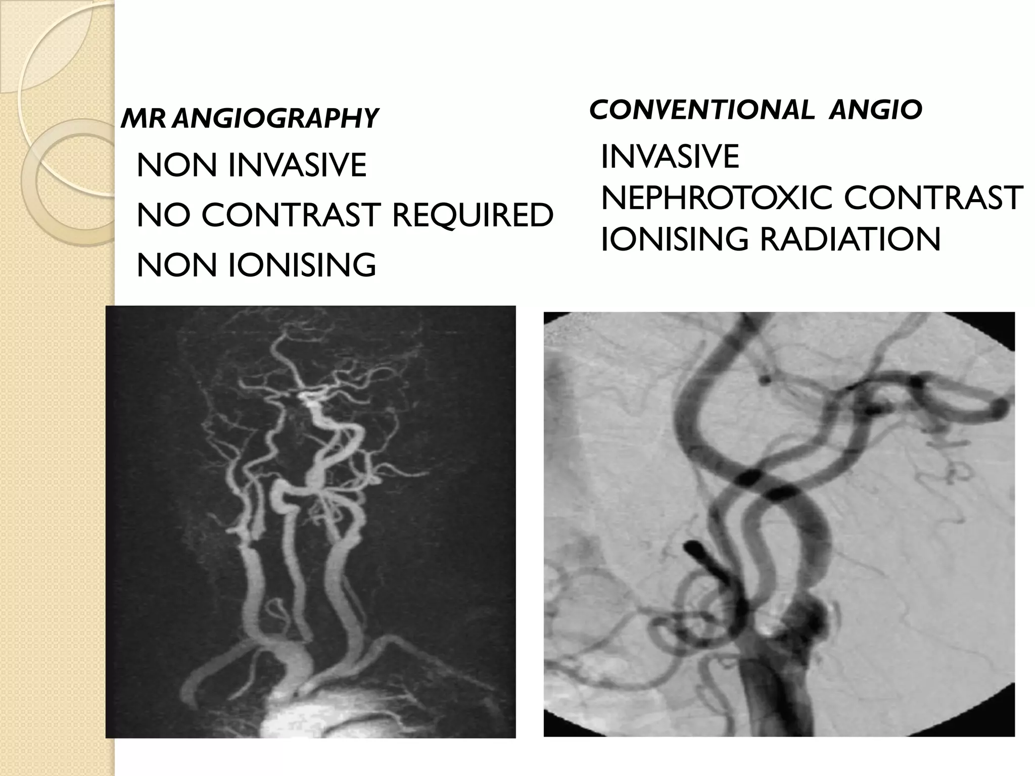 Magnetic resonance angiography | PDF