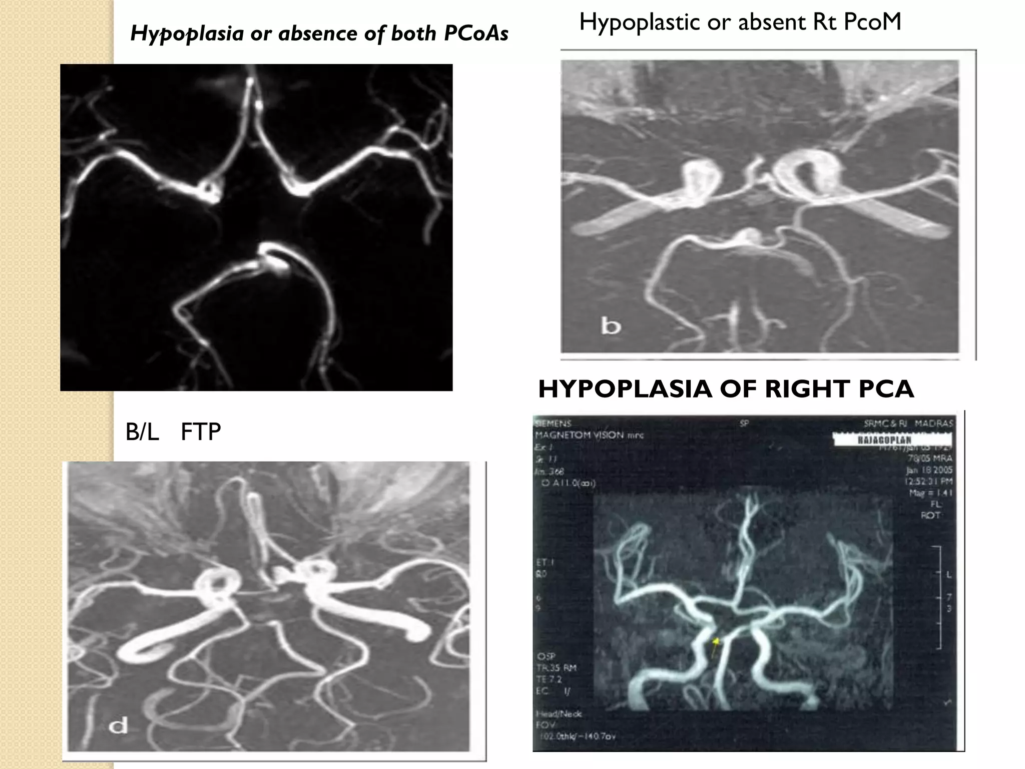 Magnetic resonance angiography | PDF