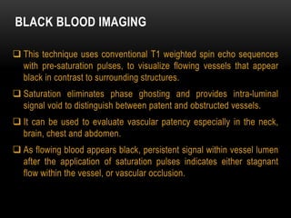 MAGNETIC RESONANCE ANGIOGRAPHY (MRA).pptx