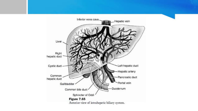 Magnetic resonance cholangiopancreatography ppt | PPTX