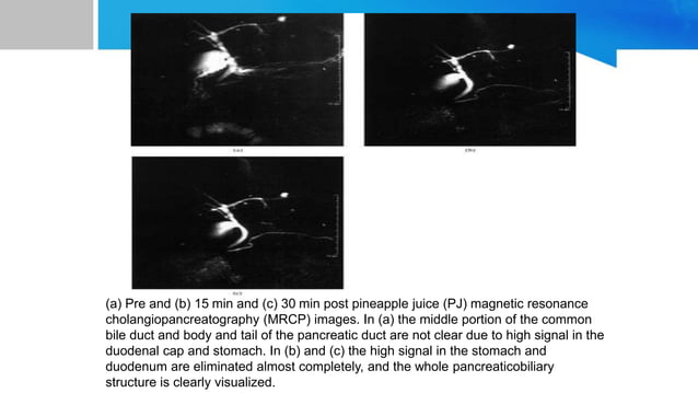 Magnetic resonance cholangiopancreatography ppt | PPTX
