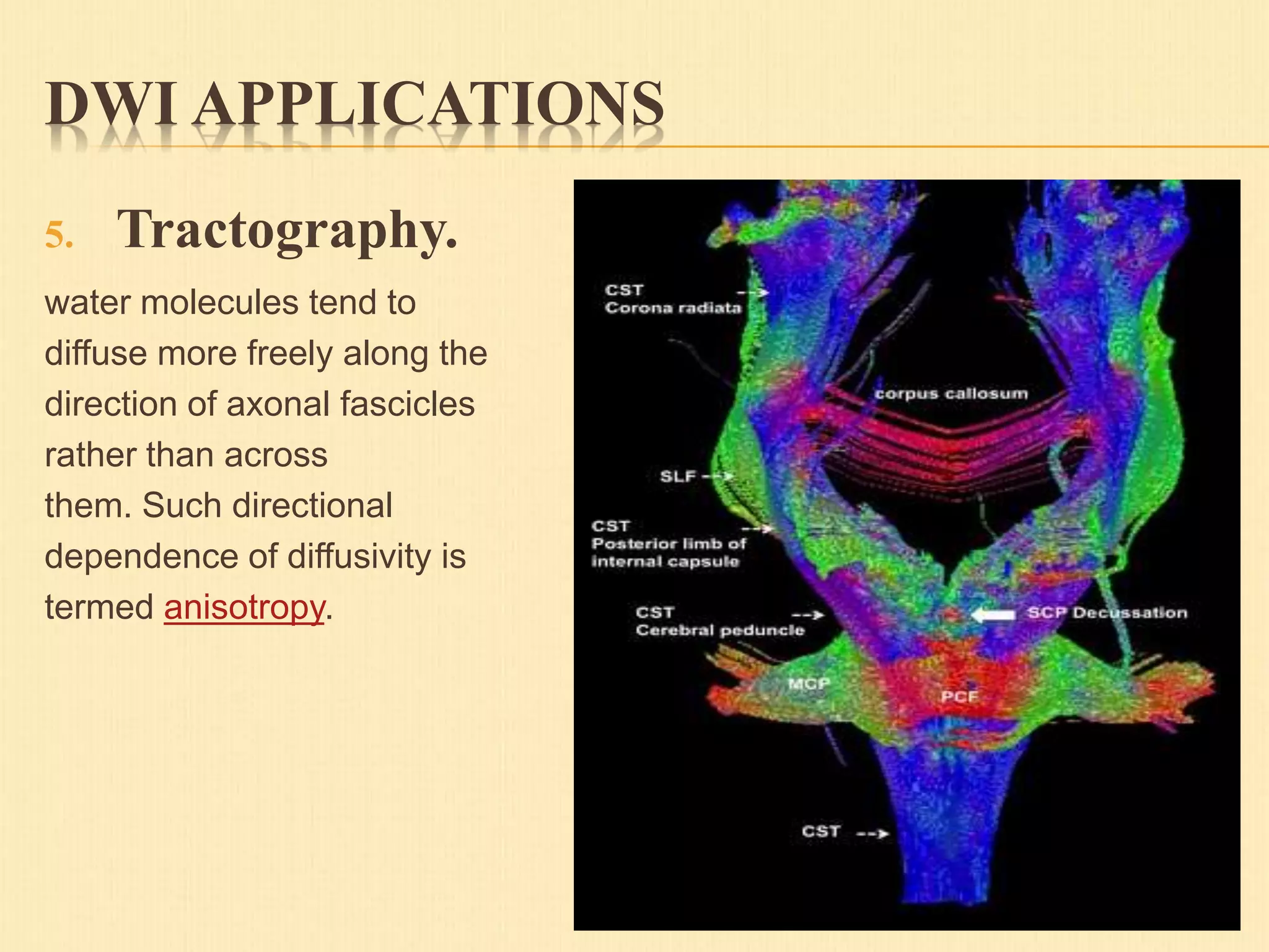 Magnetic Resonance Diffusion Weighted Imaging | PPT