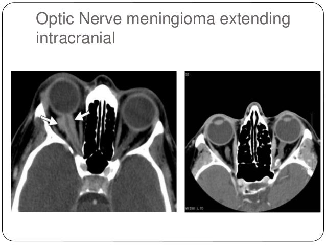 Magnetic resonance imaging
