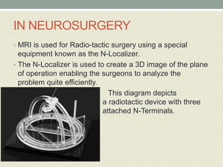 Magnetic resonance imaging | PPT