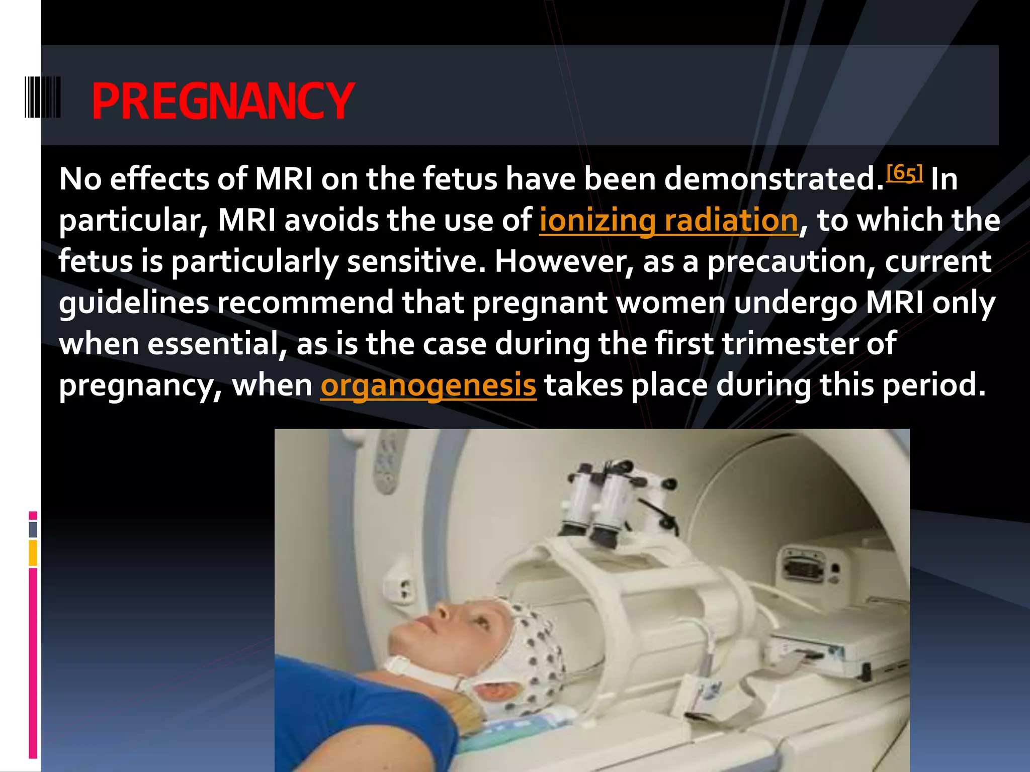 Magnetic resonance imaging | PPT
