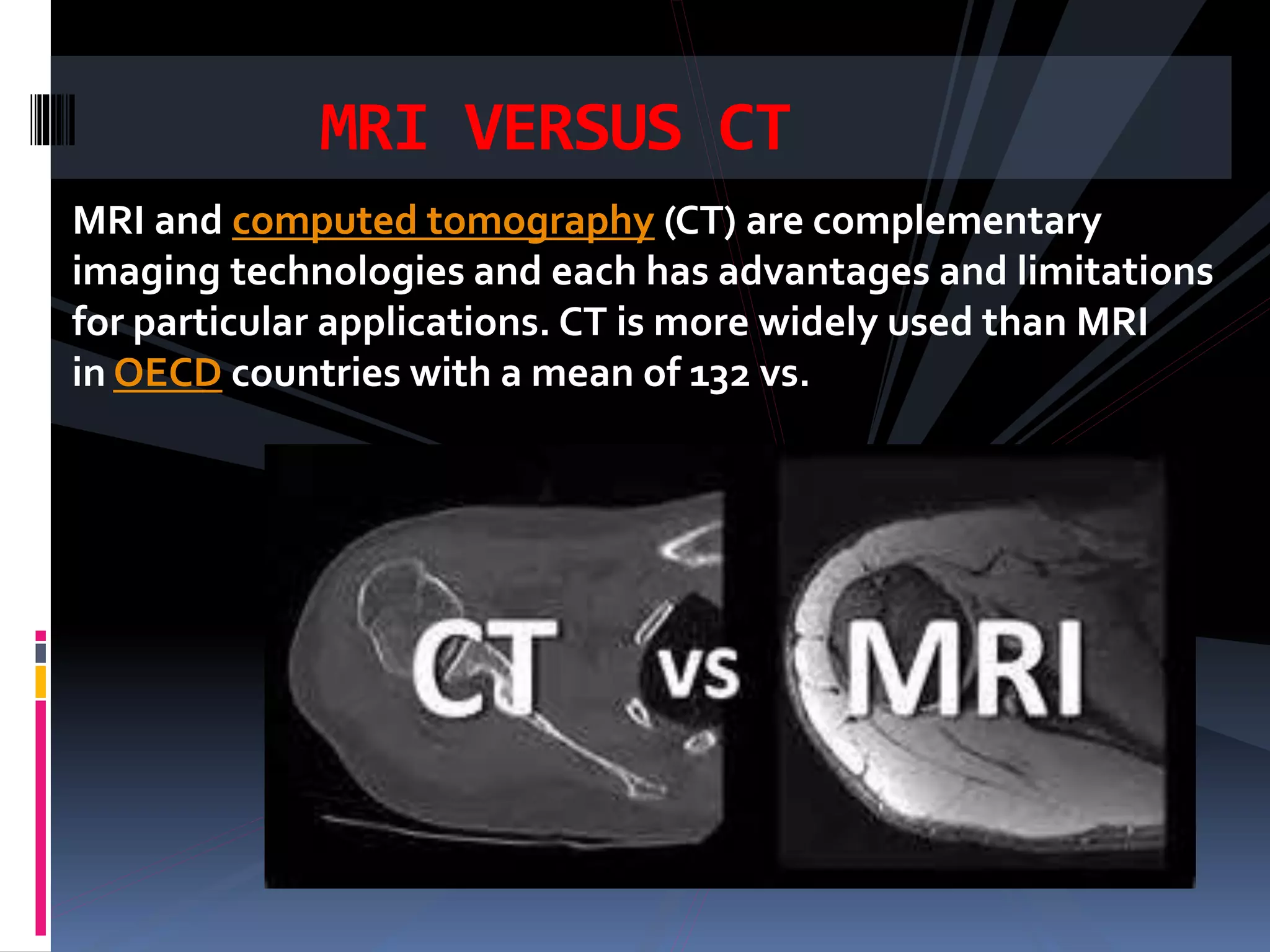 Magnetic resonance imaging | PPT