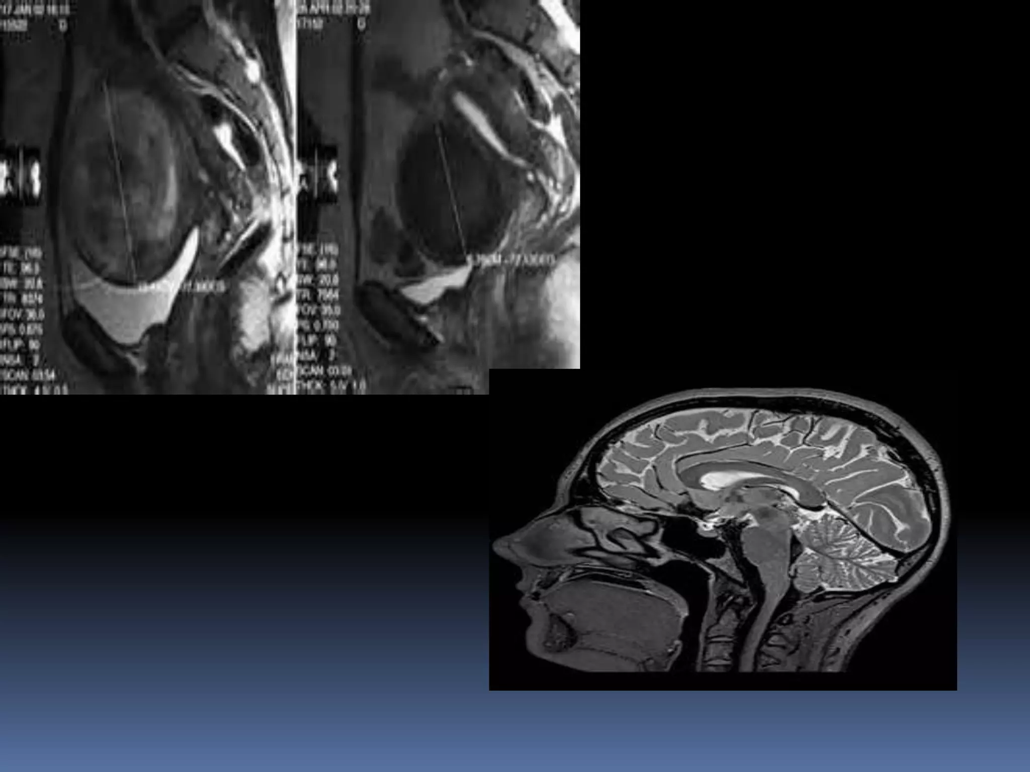 Magnetic resonance imaging | PPT