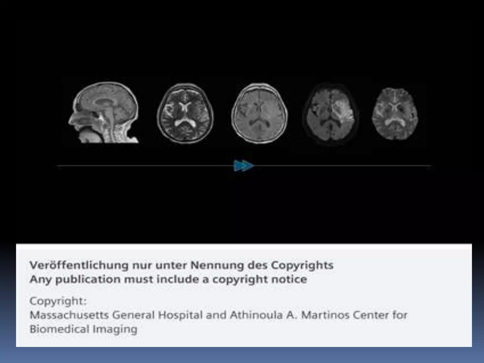 Magnetic resonance imaging | PPT