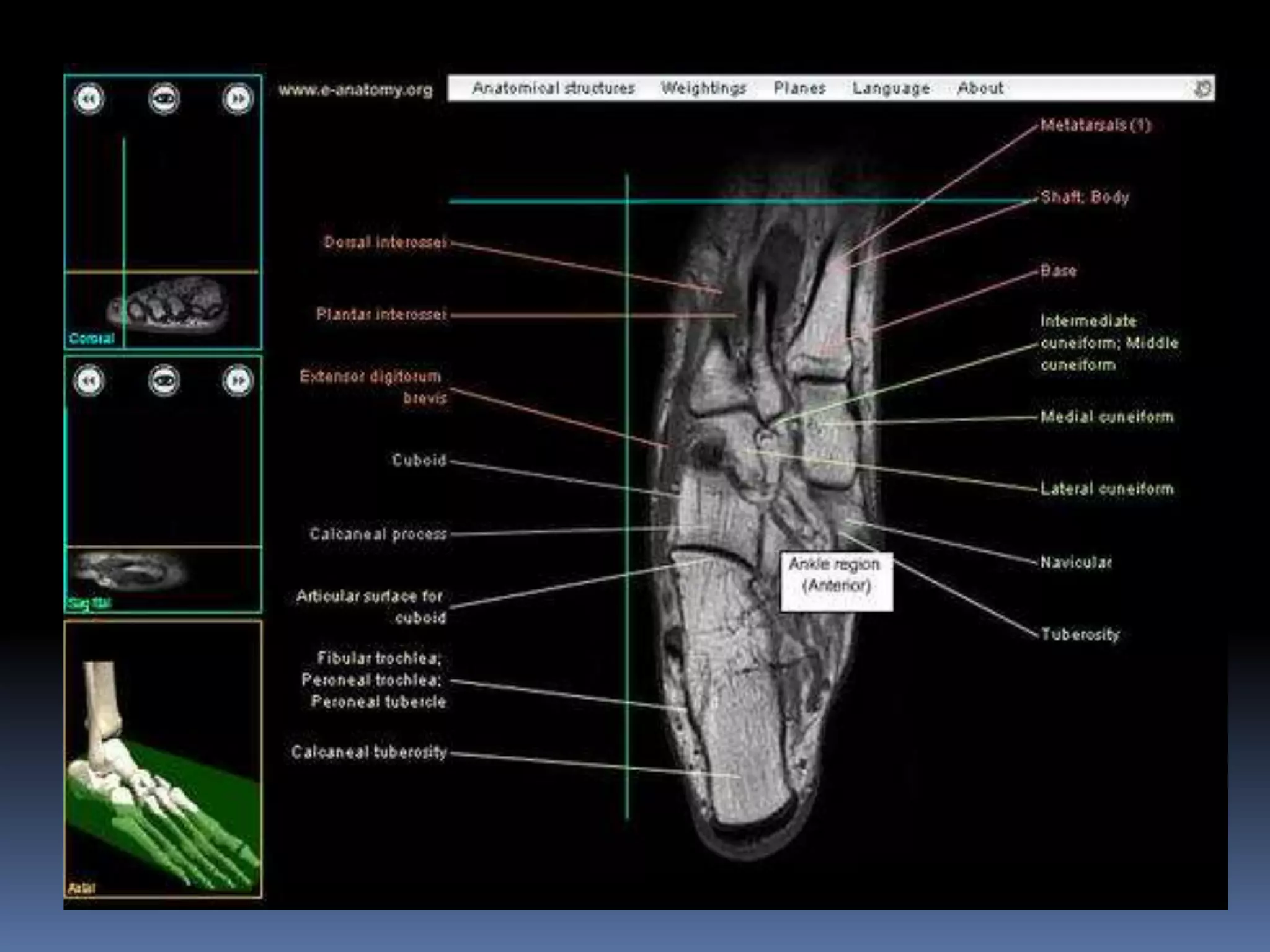 Magnetic resonance imaging | PPT