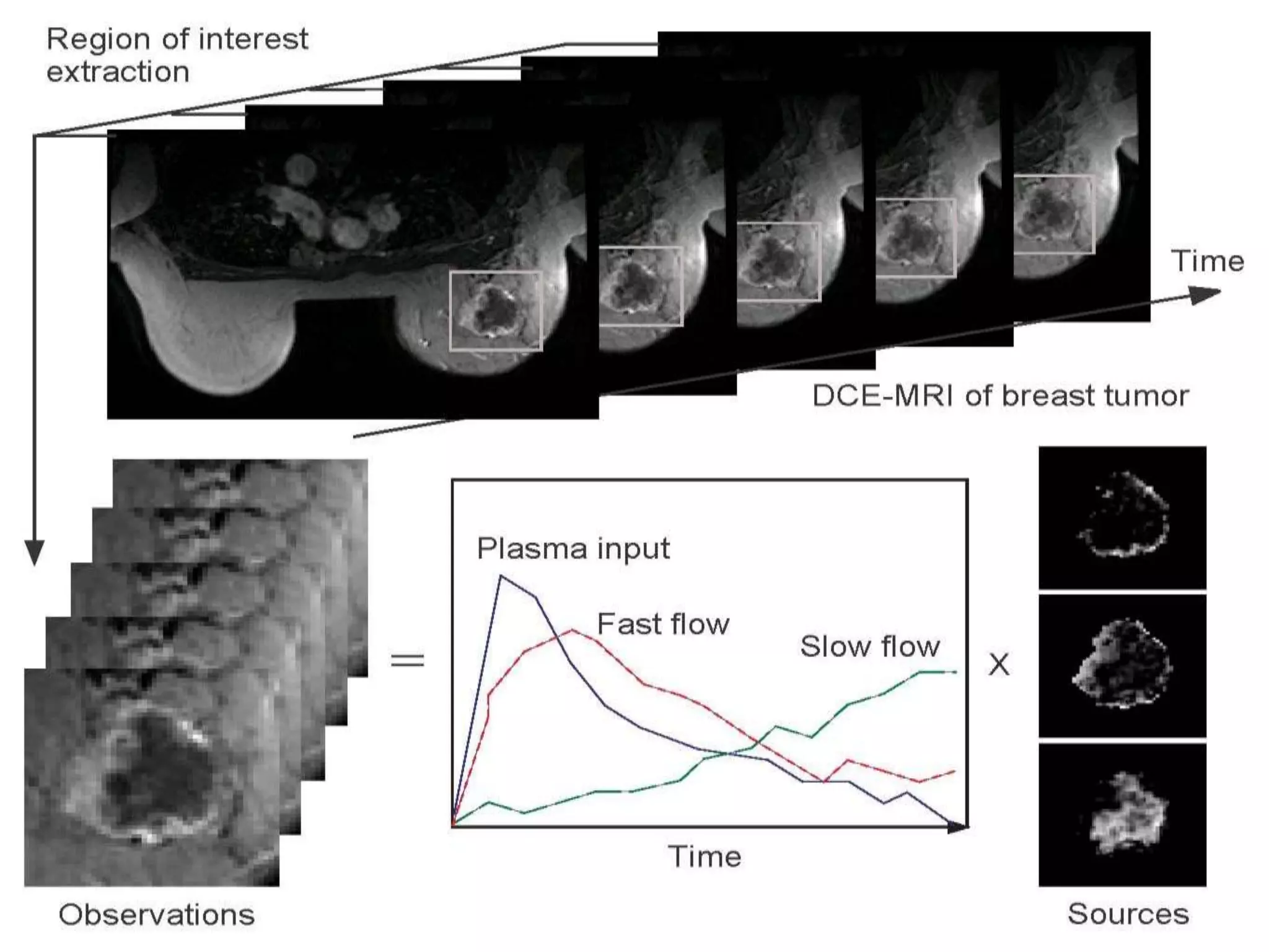 Magnetic resonance imaging | PPT