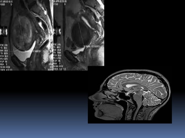 Magnetic resonance imaging | PPT