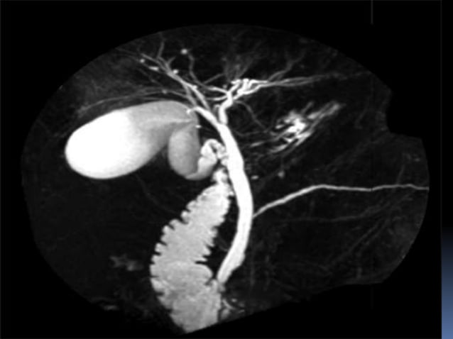 Magnetic resonance imaging | PPT