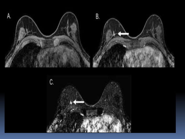 Magnetic resonance imaging | PPT