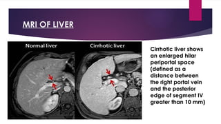 Magnetic resonance imaging (MRI) for medical students | PPTX