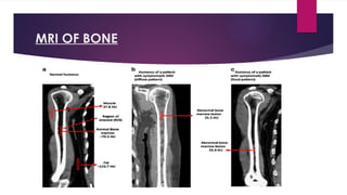 Magnetic resonance imaging (MRI) for medical students | PPTX