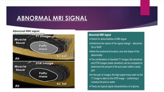 Magnetic resonance imaging (MRI) for medical students | PPTX